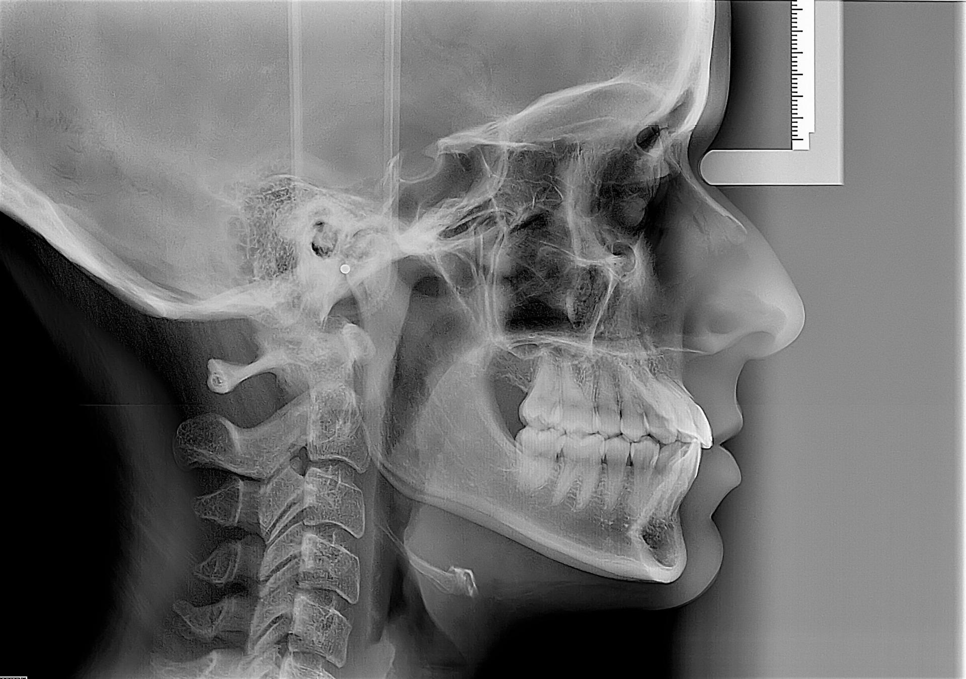 Nossos Exames - Radiologia Odontológica Dr. Murillo Torres RJ
